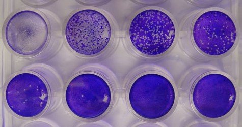 Types of antibody neutralization tests used in vaccine&drug development?