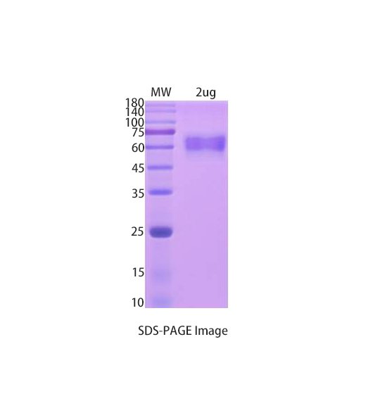Buy Human CD126/IL6R/Interleukin-6 receptor subunit alpha recombinant ...