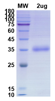 SARS-CoV-2 RBD of Spike protein, N501Y - B 1.1.7 lineage - UK Variant ...