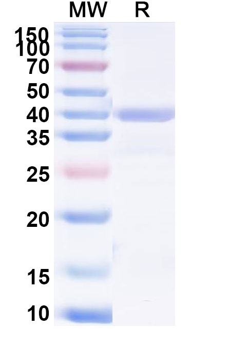 Anti-Human ATP7B VHH (SAA1241) - Buy online at ProteoGenix