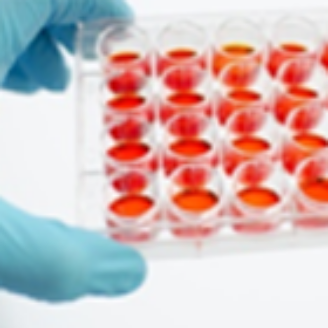 Custom protein expression services - 5 expression systems - ProteoGenix