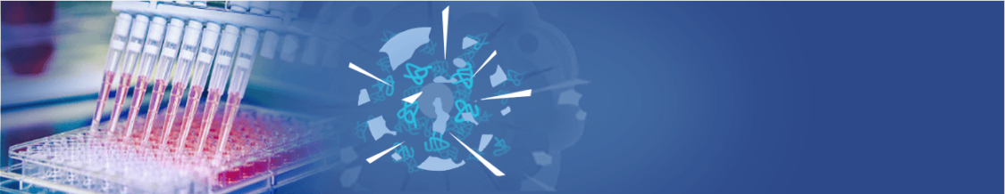 High throughput protein expression tests - ProteoGenix
