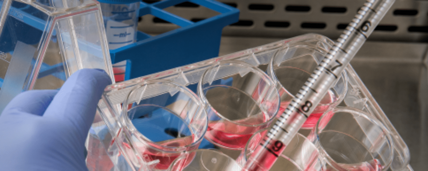 Antibody production: rabbit versus mouse, which host best fits your ...