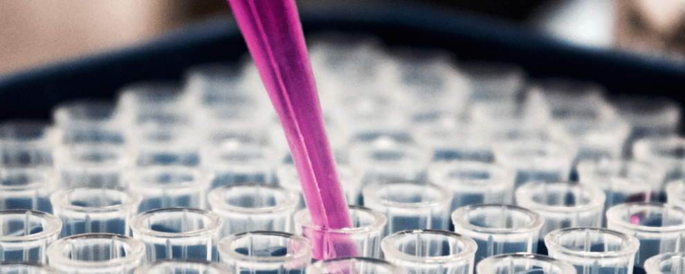 The best CHO expression system kits on the market - ProteoGenix