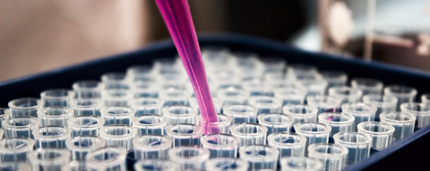 How to manufacture CAR-T cells - ProteoGenix