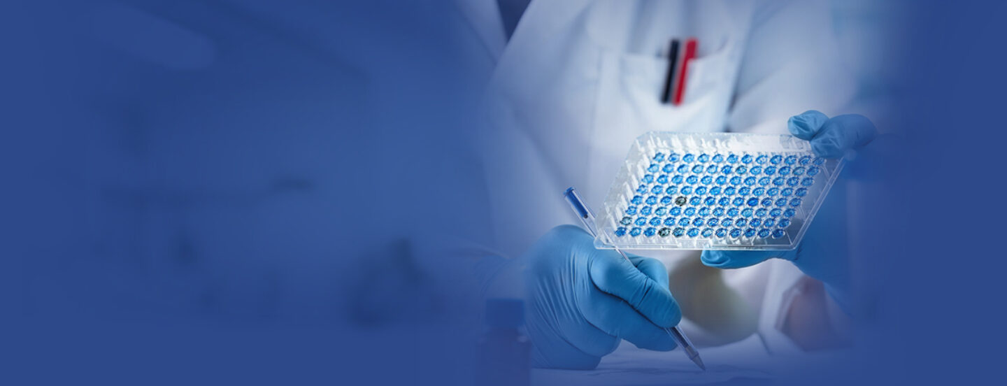 ELISA assay development services - ProteoGenix